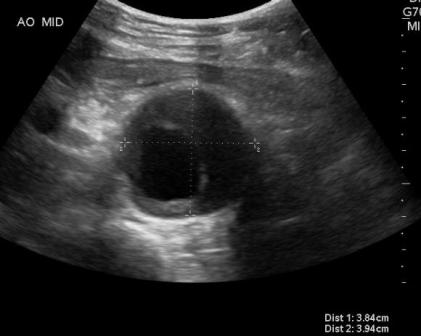 Ruptured AAA – EM Sim Cases