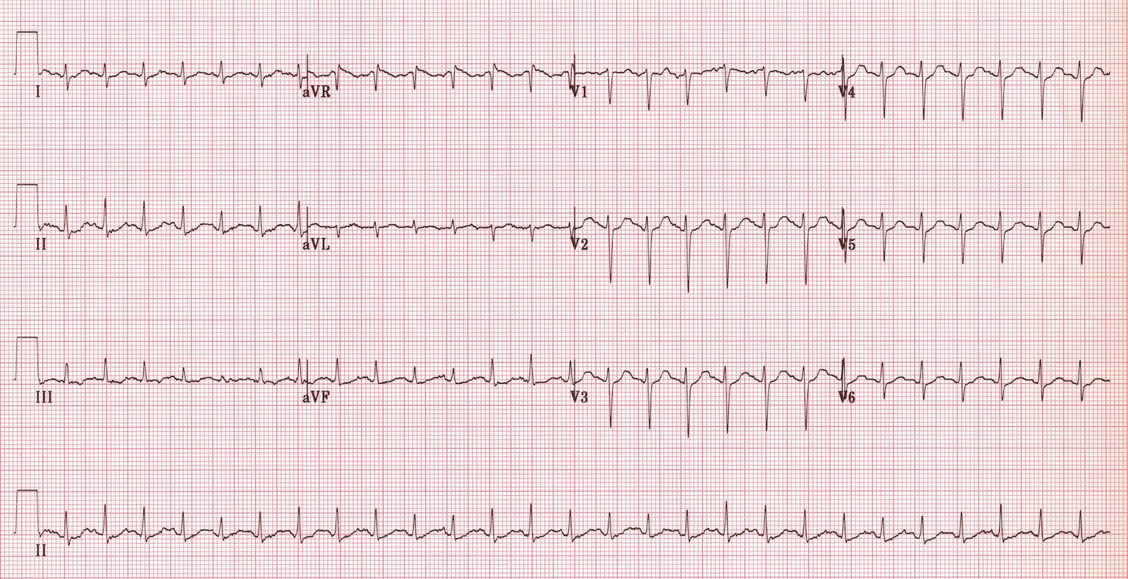 Pediatric Septic Shock – EM Sim Cases
