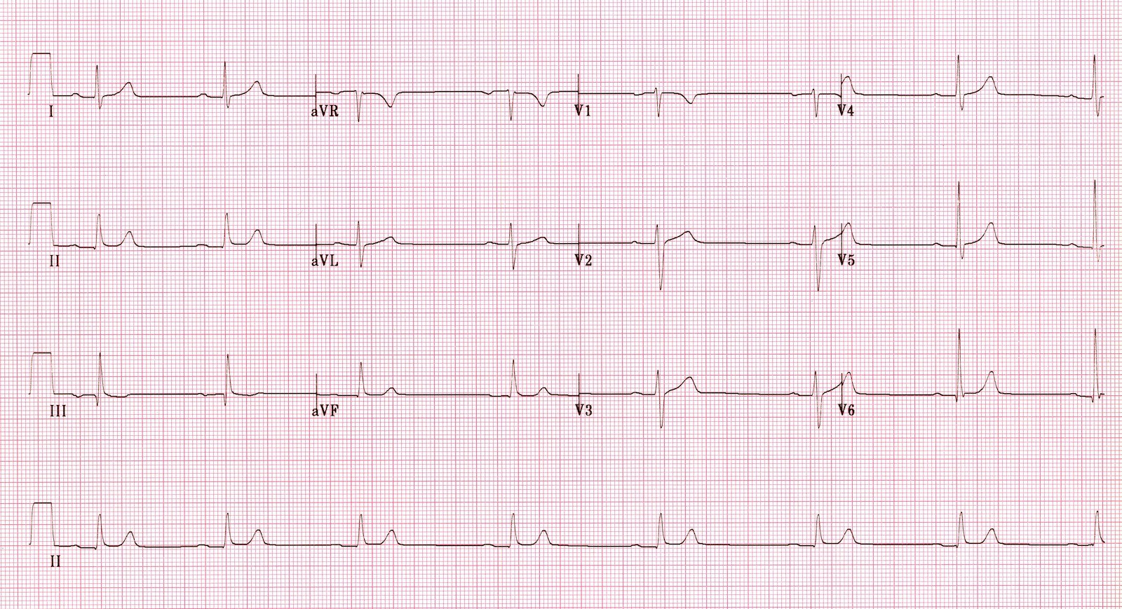 Multi-drug Overdose – EM Sim Cases