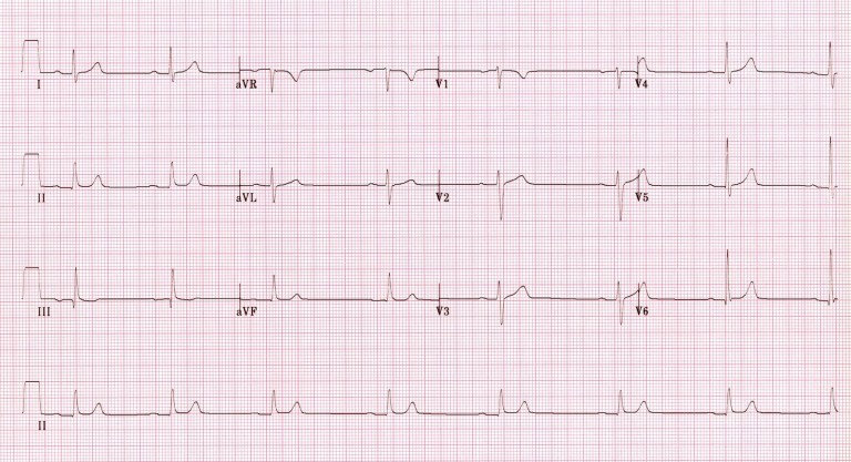 Multi-drug Overdose – EM Sim Cases