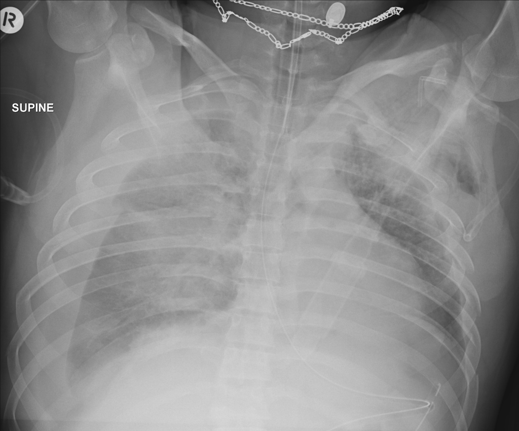 Polytrauma for Team Communication – EM Sim Cases