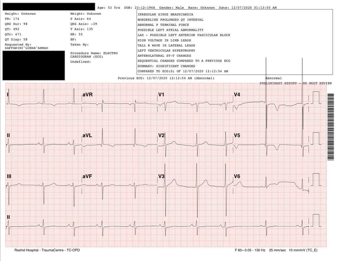Agitation and Aortic Dissection – EM Sim Cases